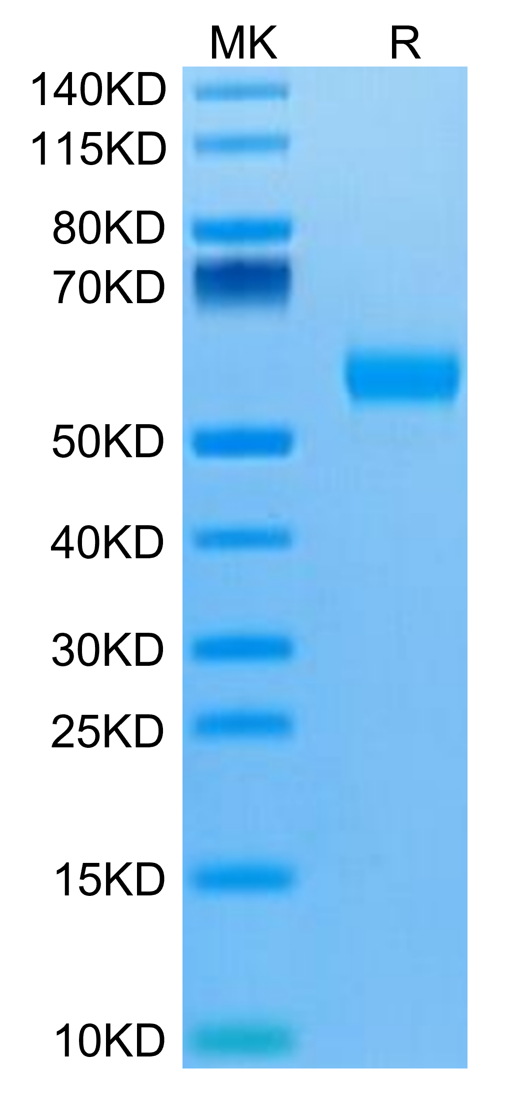 Biotinylated Human IL-5 R alpha/CD125 Protein, Active - High Quality | Beta LifeScience