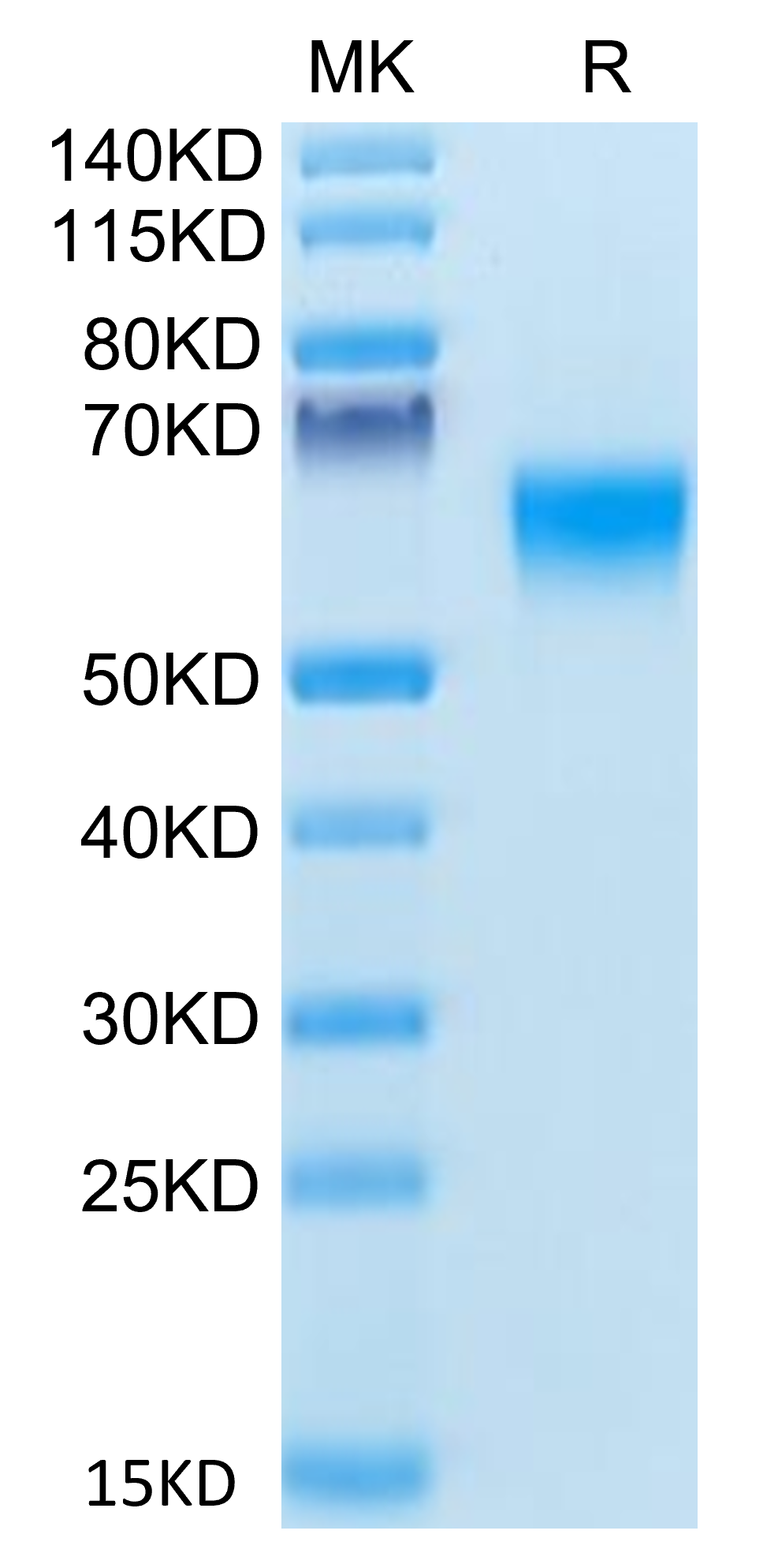 Recombinant Human BACE-1 Protein - High Quality | Beta LifeScience