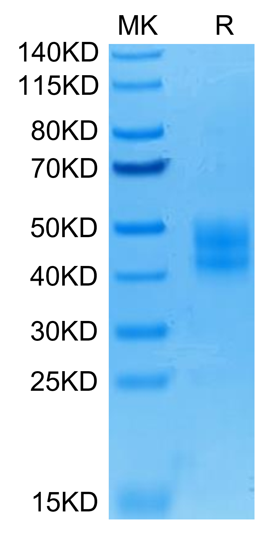 Recombinant Human B7-H3/CD276 Protein, Active - High Quality | Beta ...
