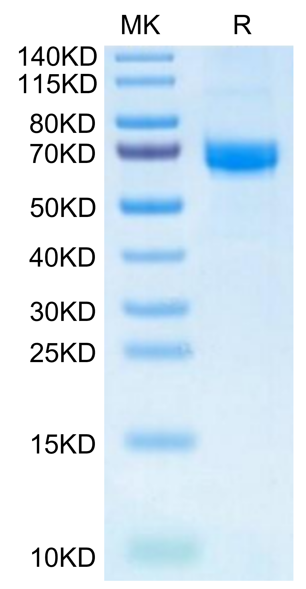 Recombinant Human Alkaline phosphatase (Intestinal type) /ALPI Protein ...