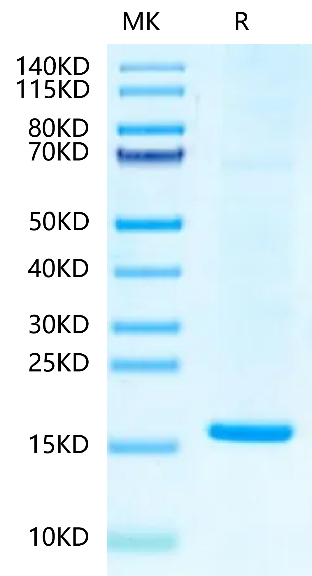 Recombinant Hepatitis B Virus (HBV) (ayw/France/Tiollais/1979) Capsid ...
